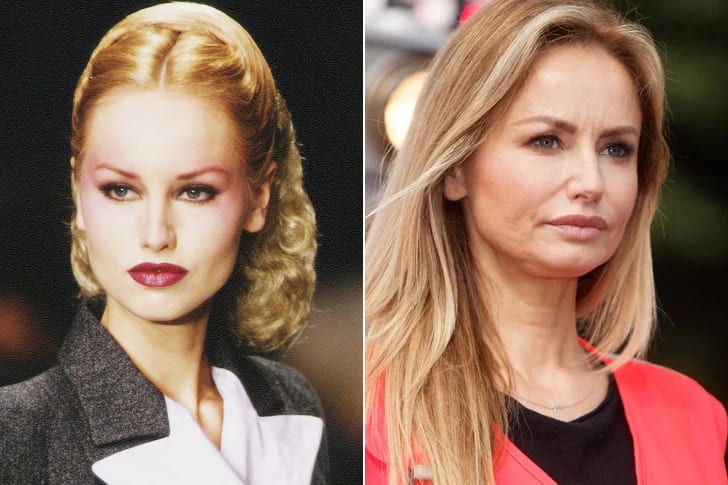 Toutes Ces Stars Françaises Ont Eu Recours à La Chirurgie Esthétique Et
